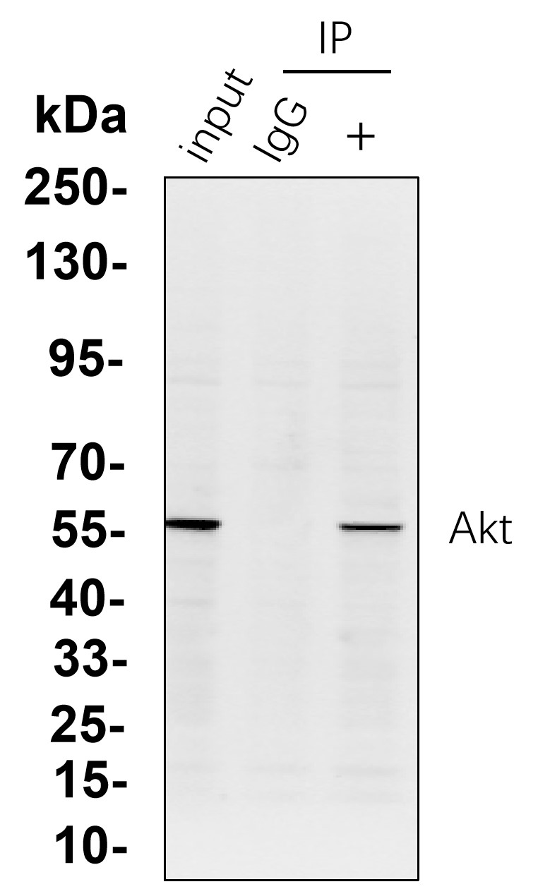 Negative Control for Rabbit IgG, kappa Primary Antibody - 产品 ...