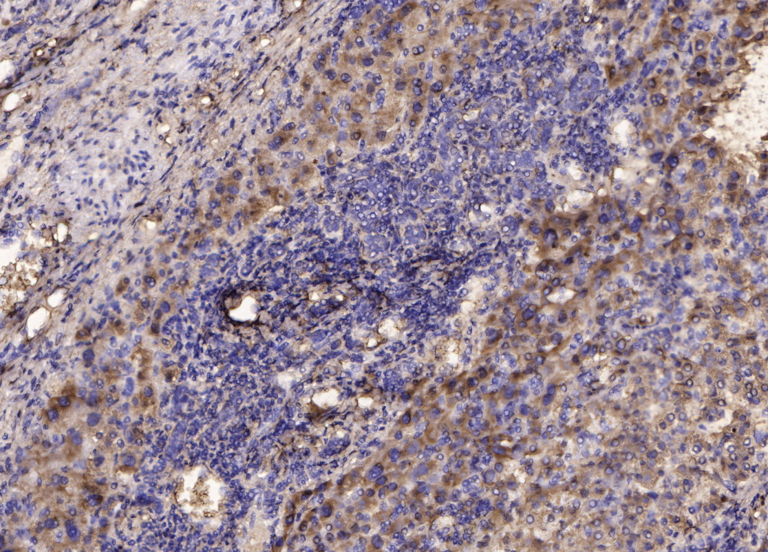 GSDME C-terminal Rabbit pAb - 产品 - Immunoway 中文官网