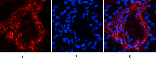 β Catenin (Phospho Thr41/Ser45) (PT0637R) PT™ Rabbit mAb - 产品 ...