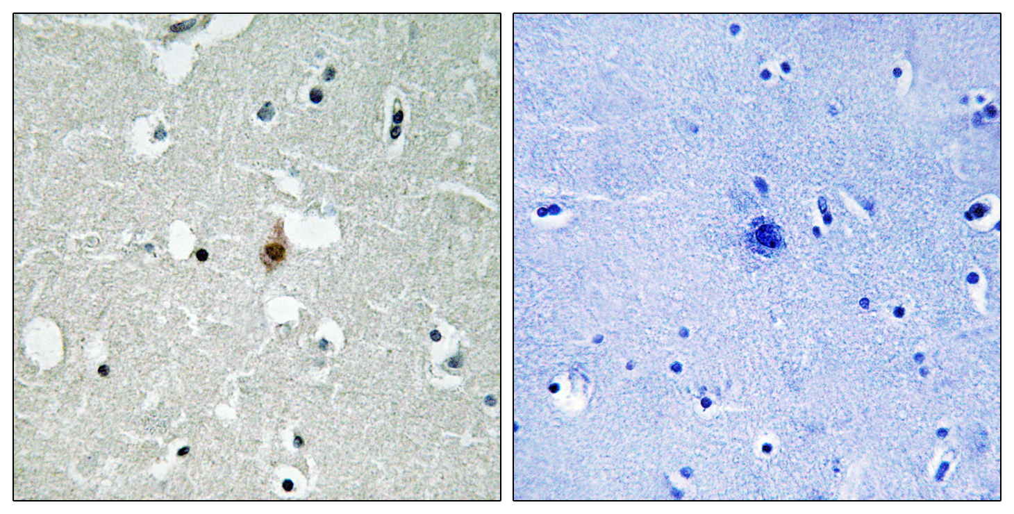 E2A Rabbit pAb - 产品 - Immunoway 中文官网