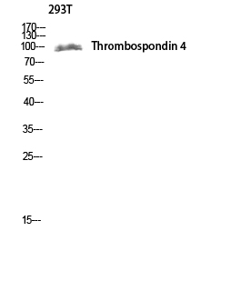 Thrombospondin 4 Rabbit pAb - 产品 - Immunoway 中文官网